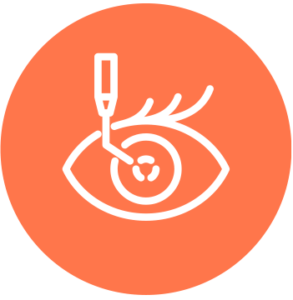 Childhood Myopia Correction Singapore | Childhood Myopia Management ...